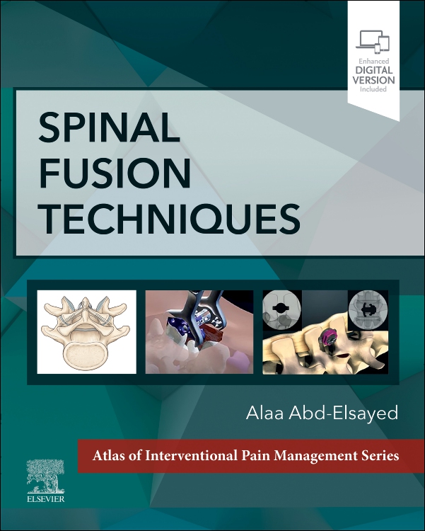 Spinal Fusion Techniques - Edition 1 - By Alaa Abd-Elsayed, MD, MBA, MPH, CPE, FASA Elsevier ...