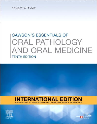 Cawson's Essentials of Oral Pathology and Oral Medicine, International Edition - Edition 10 - By ...