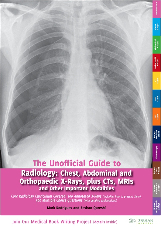 The Unofficial Guide to Radiology: 100 Practice Chest X-Rays - Edition ...