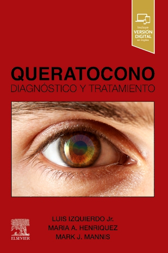 Queratocono - Edition 1 - By Luis Izquierdo, MD, PhD, Maria A ...